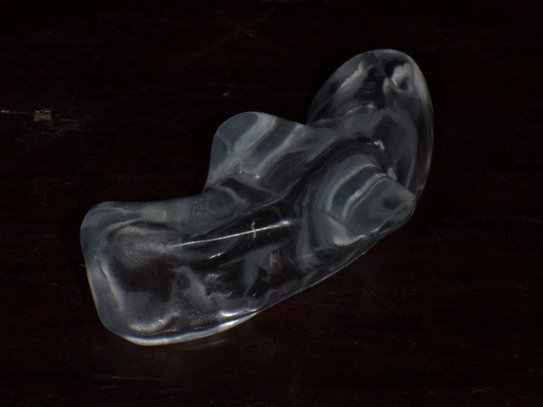 Nightguard and NTI | Oldsmar Dentistry